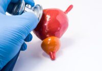 Bladder Neck Contracture | Urologist | Keith Rourke, MD ...